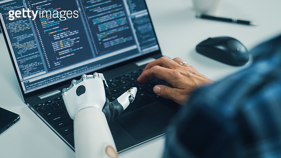 Over Shoulder Hands Close-up: Programmer With Disability Using Prosthetic Arm to Work on Laptop ...