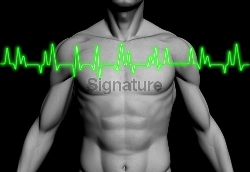 Electrocardiogram (ECG / EKG) with human body 이미지 (172331235) - 게티이미지뱅크