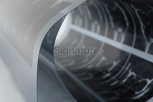 Cat scan roll 이미지 (106477302) - 게티이미지뱅크