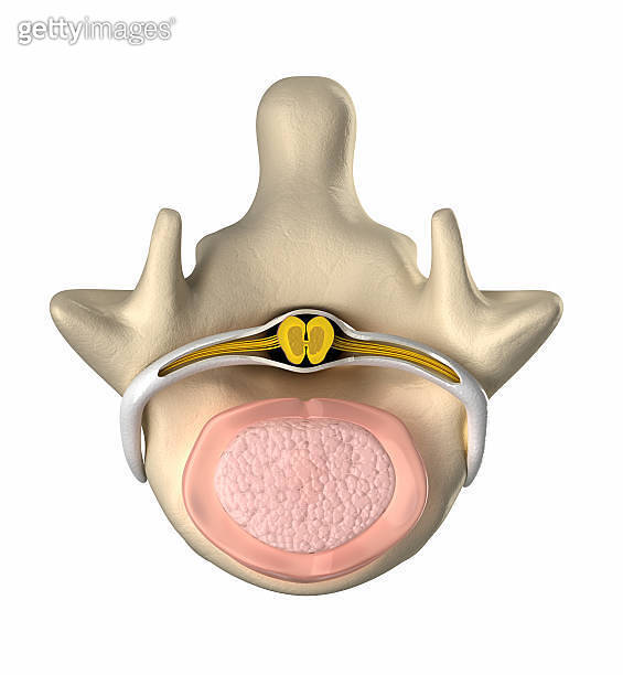 Human intervertebral disc cross-section (156998685) - 게티이미지뱅크