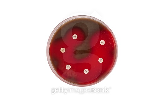 Antibiogram showing sensibility to Streptococcus bacteria on petri dish ...