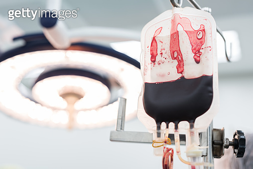 giving packed red cell blood during surgery 이미지 (534939489) - 게티이미지뱅크