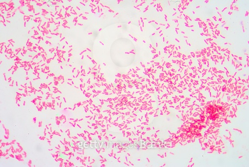 Gram staining ,gram negative bacilli. 이미지 (470685710) - 게티이미지뱅크