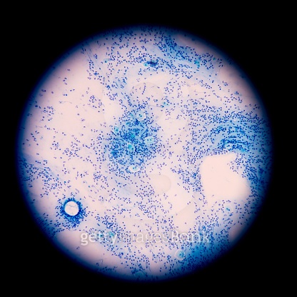 Slide sputum AFB.Negative find with microscope 이미지 (484374380) - 게티이미지뱅크