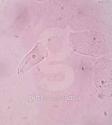 squamous epithelial cell in urine. 이미지 (480694460) - 게티이미지뱅크
