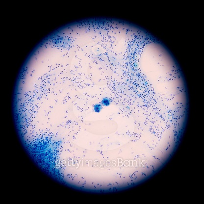 Slide sputum AFB.Negative find with microscope (484431864) - 게티이미지뱅크