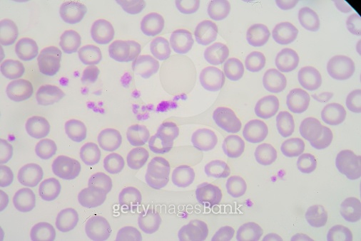 platelet clumping 이미지 (537984951) - 게티이미지뱅크