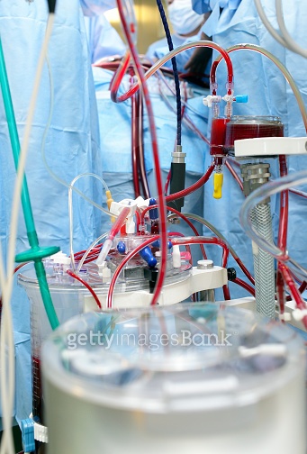 Tubes with blood, complex medical device in the operating room. 이미지 ...
