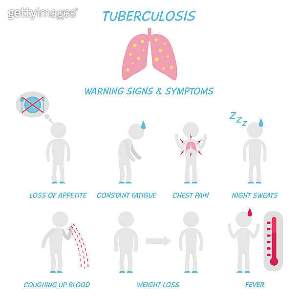 Tuberculosis warning signs and symptoms. 이미지 (500968176) - 게티이미지뱅크