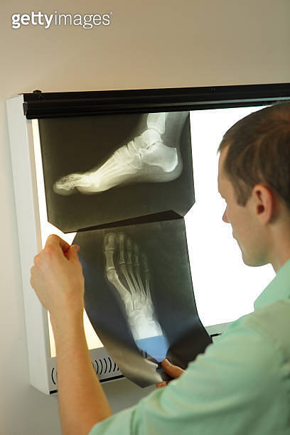 watching images of foot at x-ray film viewer 이미지 (514997974) - 게티이미지뱅크