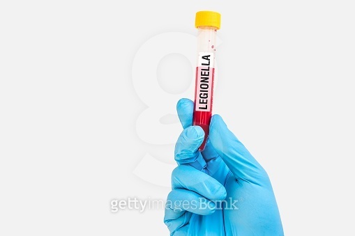 Test-tube with blood sample for LEGIONELLA test (545677358) - 게티이미지뱅크