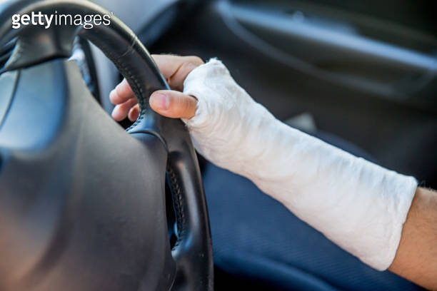 Young Adult Man wearing Cast and Driving Car 이미지 (827499426) - 게티이미지뱅크
