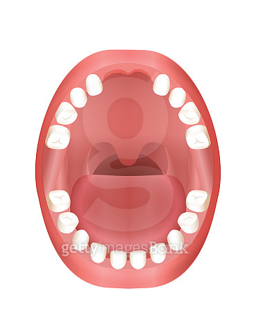 Front teeth missing - illustration of a childs mouth with primary ...