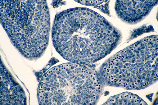 Cross section Human testis under microscope view. (680300368) - 게티이미지뱅크