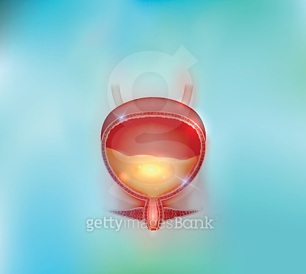 Urinary bladder beautiful blue background 이미지 (649469490) - 게티이미지뱅크