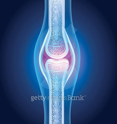 Normal joint anatomy 이미지 (649469018) - 게티이미지뱅크
