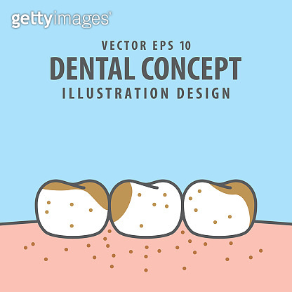 Dirty teeth illustration vector on blue background. Dental concept. 이미지 ...