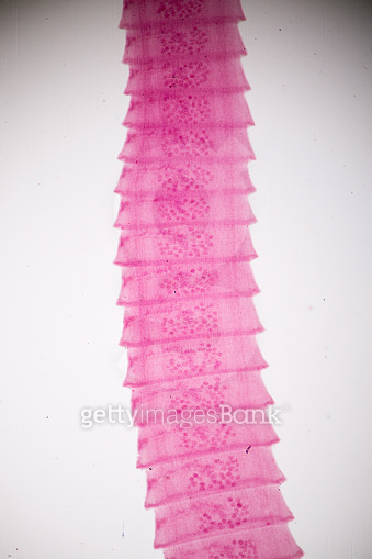 Raillietina echinobothrida is a parasitic tapeworm belonging to the ...