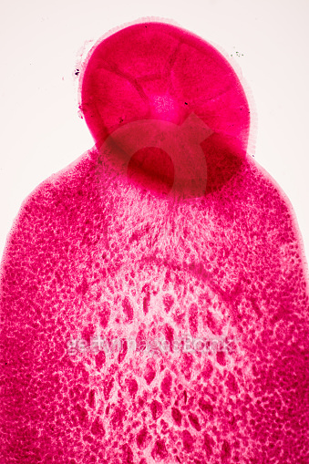 Flukes infestation (parasite) under microscope view. (694113168) - 게티이미지뱅크