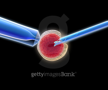 3D rendering of the icsi(intracytoplasmic sperm injection) process - in ...