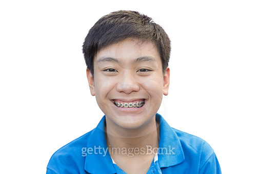 Young man smile with teeth brace dental on isolate background. 이미지 ...