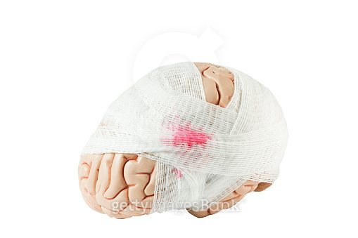 Brain model with gauze wrapping in oblique view (833388084) - 게티이미지뱅크