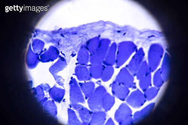 skeletal muscle cross section in microscopy 이미지 (666489356) - 게티이미지뱅크
