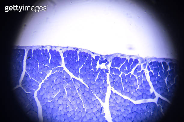 skeletal muscle cross section in microscopy 이미지 (666489786) - 게티이미지뱅크