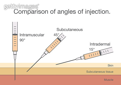 Comparison of the angles of intramuscular injection. 이미지 (812570804 ...