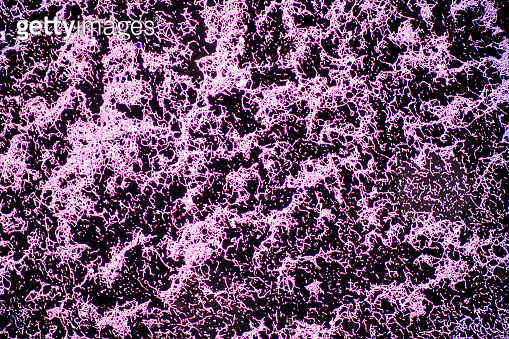 Bacillus is a genus of gram-positive, rod-shaped bacteria and a member ...