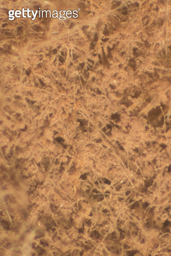 A hypha is a long, branching filamentous structure of a fungus ...