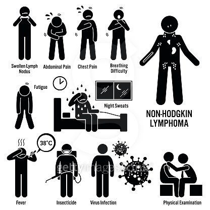Non-Hodgkin Lymphoma Lymphatic Cancer Symptoms Causes Risk Factors ...