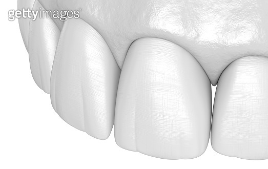 Maxillary human teeth - incisors. Medically accurate tooth 3D ...