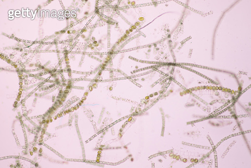 Filamentous algae are single algae cells that form long visible chains ...