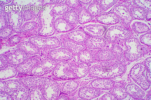 Cross section Human testis under microscope view. Shows spermatogonia ...