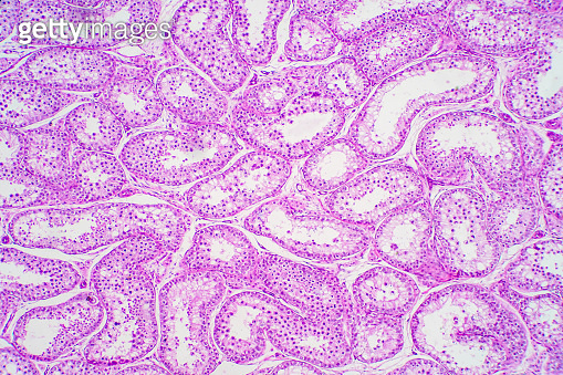 Cross section Human testis under microscope view. Shows spermatogonia ...