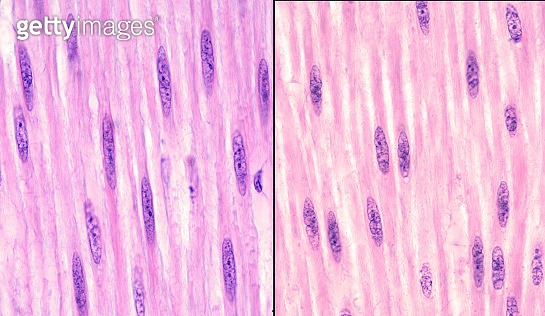 Smooth muscle fiber nuclei 이미지 (1086669228) - 게티이미지뱅크