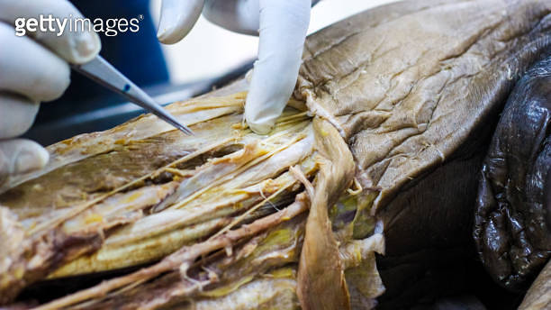 Anatomy dissection of a cadaver showing adductor canal using scalpel ...