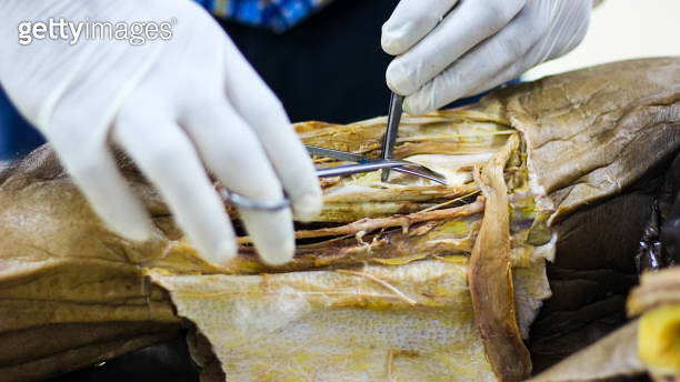 Anatomy dissection of a cadaver showing adductor canal using scalpel ...