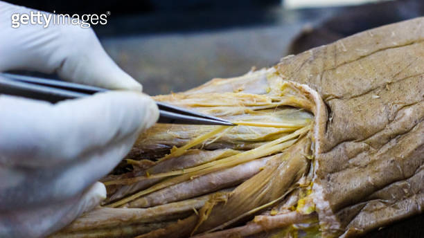 Anatomy dissection of a cadaver showing adductor canal using scalpel ...