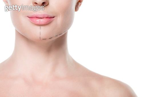 Cropped view of woman with painted lines on face for plastic surgery ...