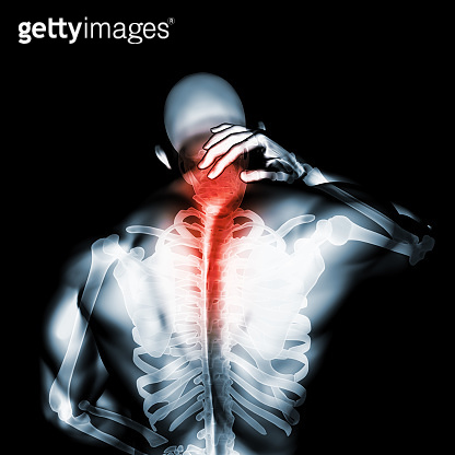 Neck painful - cervical spine skeleton x-ray, 3D illustration ...