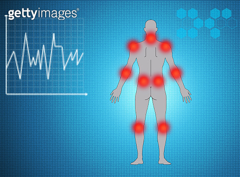 Man red pain points. Vector illustration, medical infographics 이미지 ...