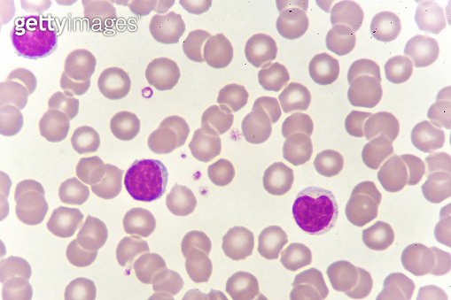 Lymphocyte cells in blood smear (941910244) - 게티이미지뱅크