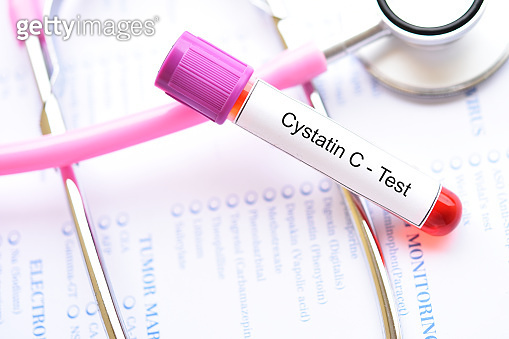 Blood sample tube for cystatin C test (1063334778) - 게티이미지뱅크