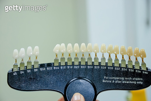 Dentist checking and selecting color of teeth.Hands holding tooth shade ...