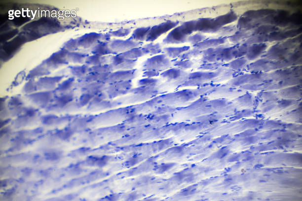 skeletal muscle longitudinal section in microscopy (940719578) 일러스트, 무료 ...
