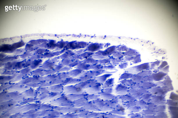 skeletal muscle longitudinal section in microscopy 이미지 (940719610) - 게티 ...