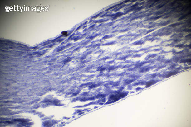 skeletal muscle longitudinal section in microscopy (940719398) - 게티이미지뱅크