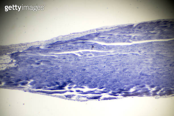 skeletal muscle longitudinal section in microscopy 이미지 (940719438) - 게티 ...